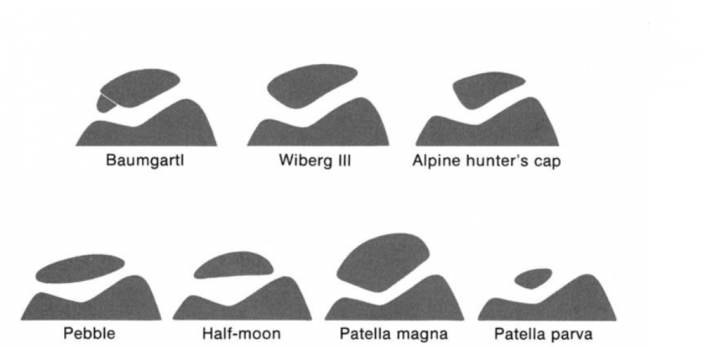 ¿Cómo se recupera una luxación de rótula o subluxación? | Entrena con Élite